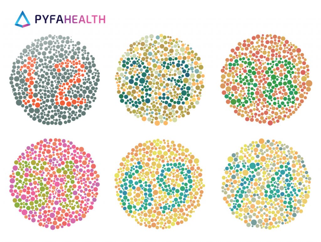 Mengenal Apa itu Tes Buta Warna