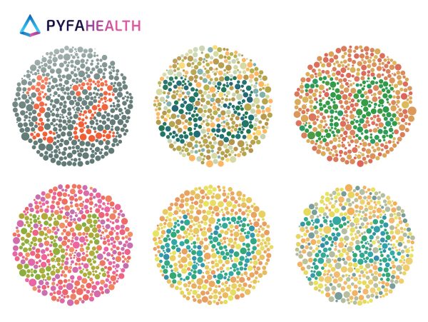 Mengenal Apa itu Tes Buta Warna