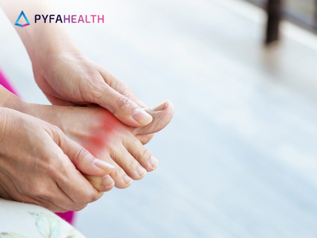 Gejala Asam Urat pada Kaki dan Penanganannya