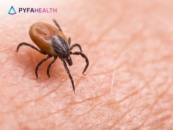 Ciri-Ciri Digigit Tungau Kasur dan Cara Mengatasinya - PYFA Health