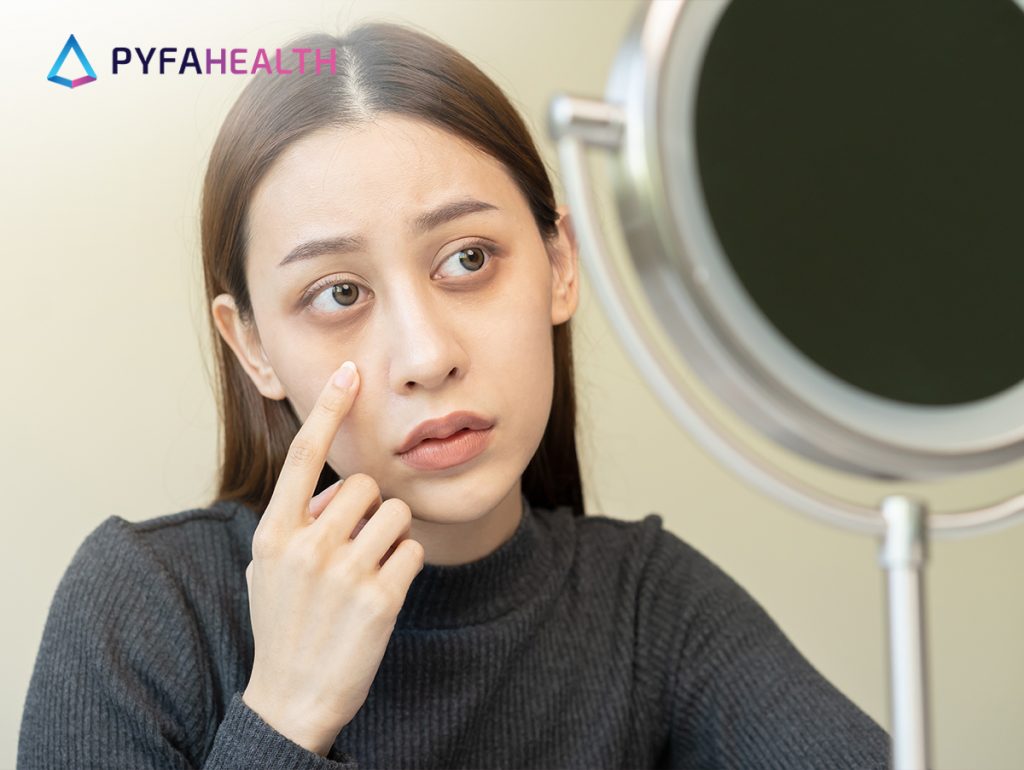 Praktis, 5 Cara Menghilangkan Hitam di Bawah Mata di Rumah!