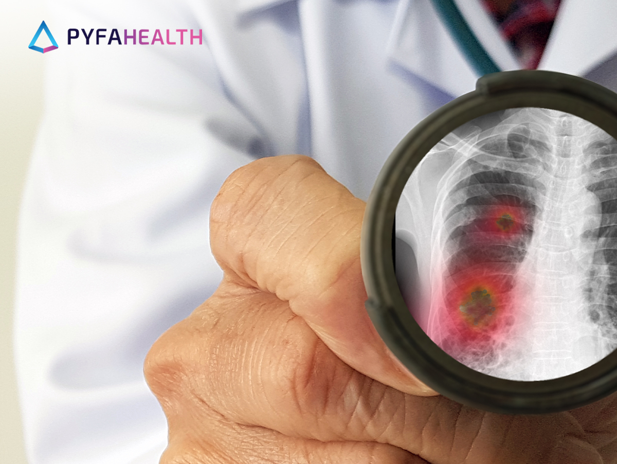 Pneumonia: Penyebab, Gejala, Penanganan, dan Pencegahan