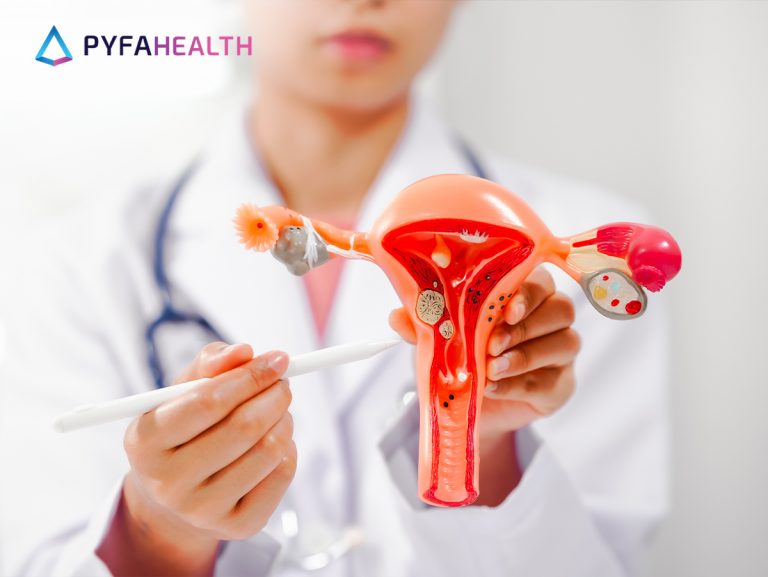 Apa itu Ovarium? Ketahui Fungsi dan Gangguannya - PYFA Health