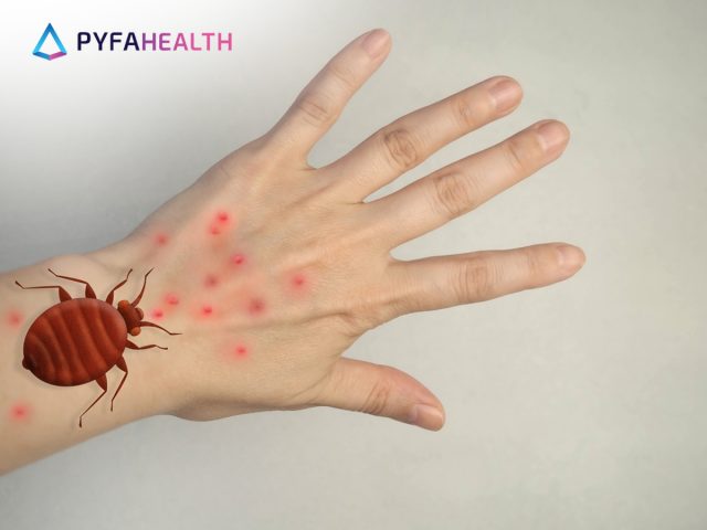 Bintik Merah Gatal Menyebar: Penyebab, Gejala, dan Cara Mengatasinya